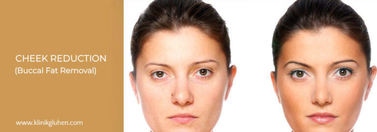 Cheek Reduction - Klinik Glühen